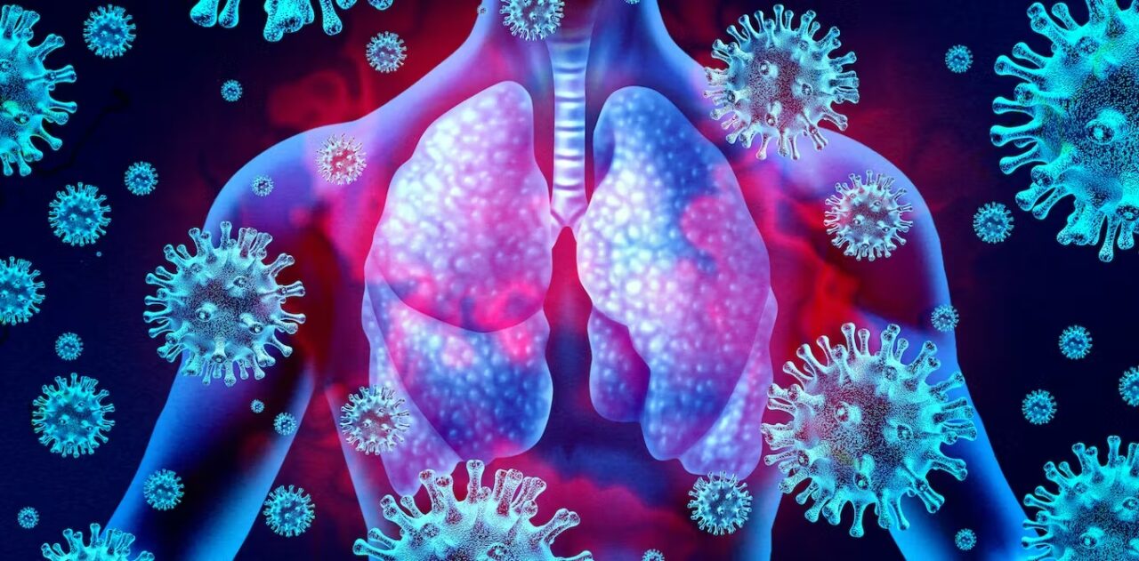 Respiratory Diseases: Identifying Causes and Taking Preventive Measures ...